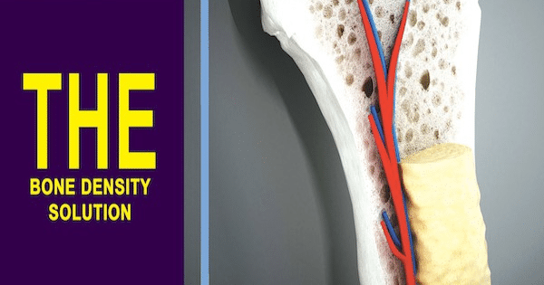 The Bone Density Solution Review: Does Shelly Manning's Program Work?